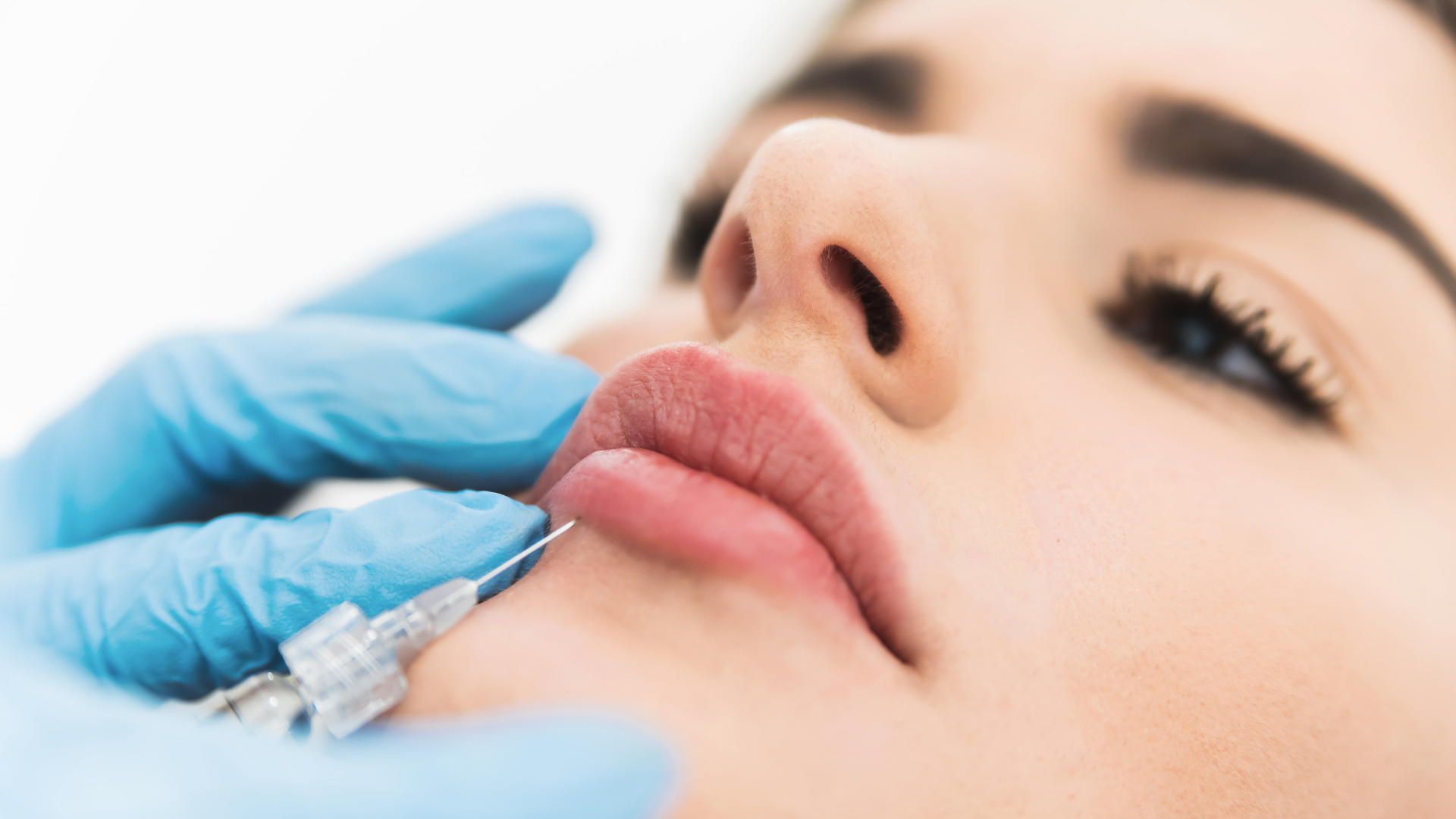 Nos conseils post-injections à l'acide hyaluronique | Dentistes à Montesson Nos conseils post-injections à l'acide hyaluronique | Dentistes à Montesson